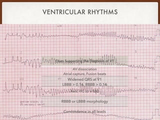 ECG interpretation moonlighting medicine | PDF
