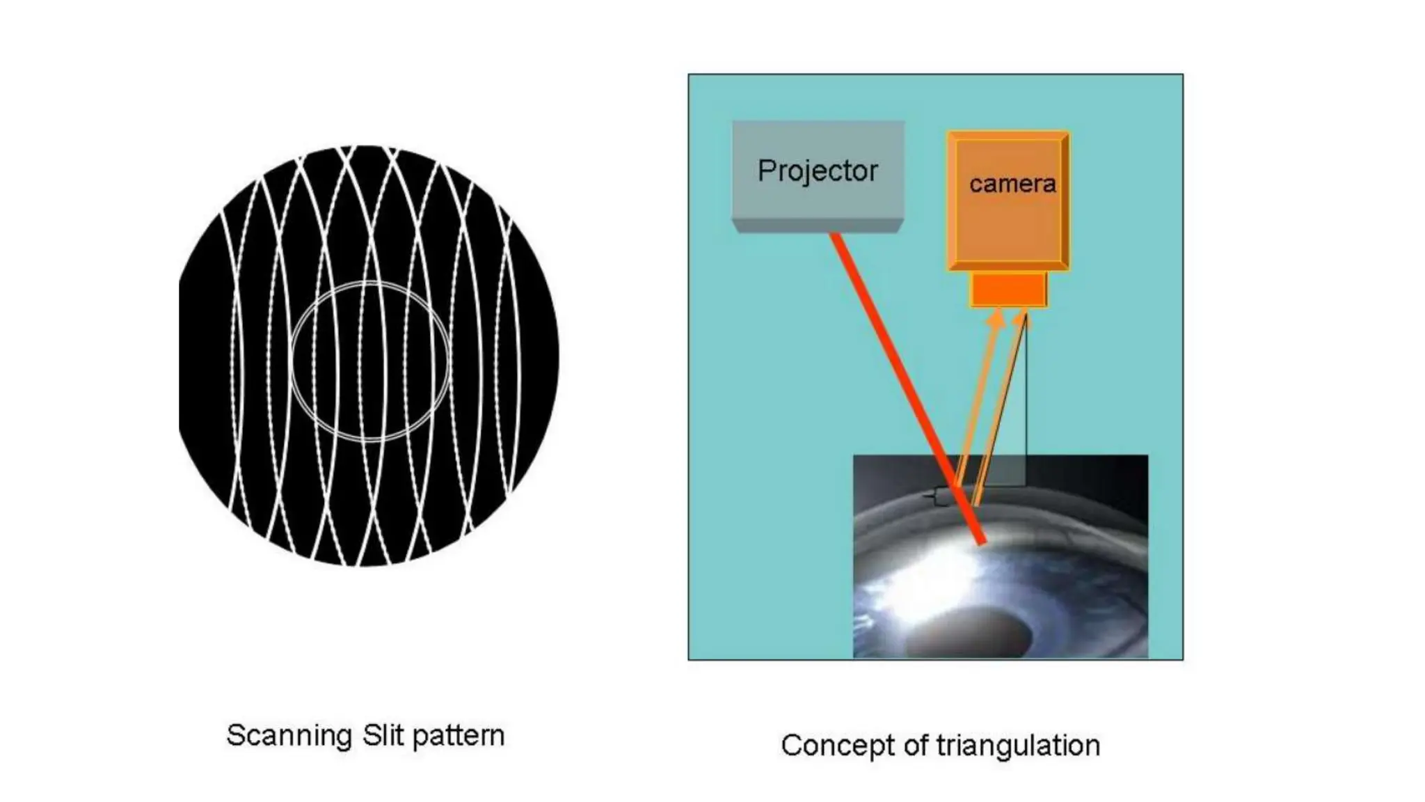 Topography and Tomography of cornea in detail | PPTX