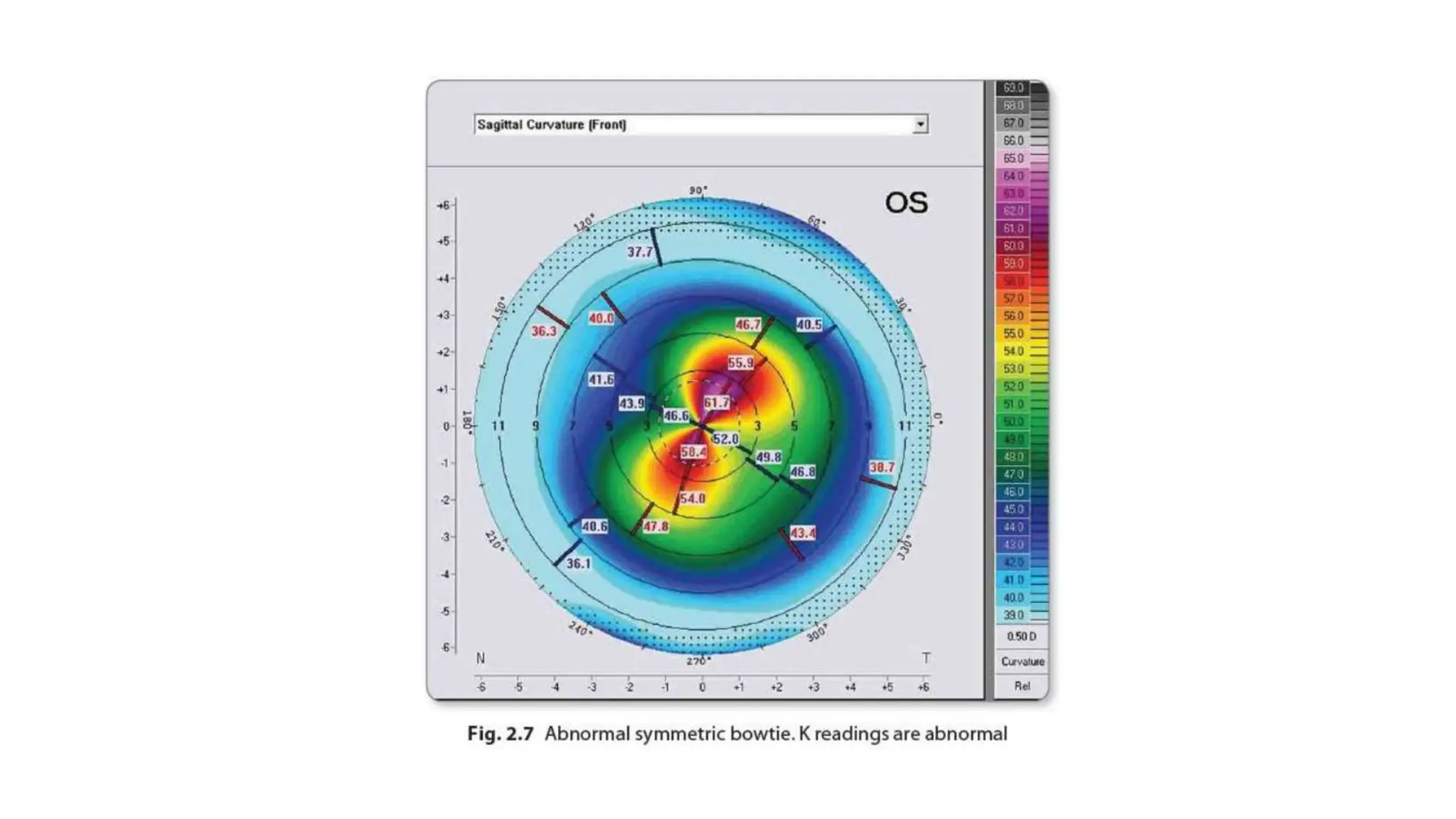 Topography and Tomography of cornea in detail | PPTX