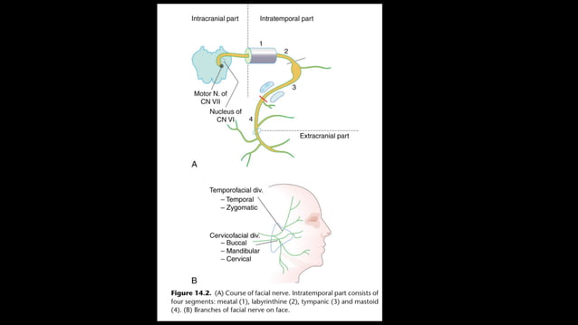 Topodiagnostic and electrophysiological tests of facial nerve .pptx
