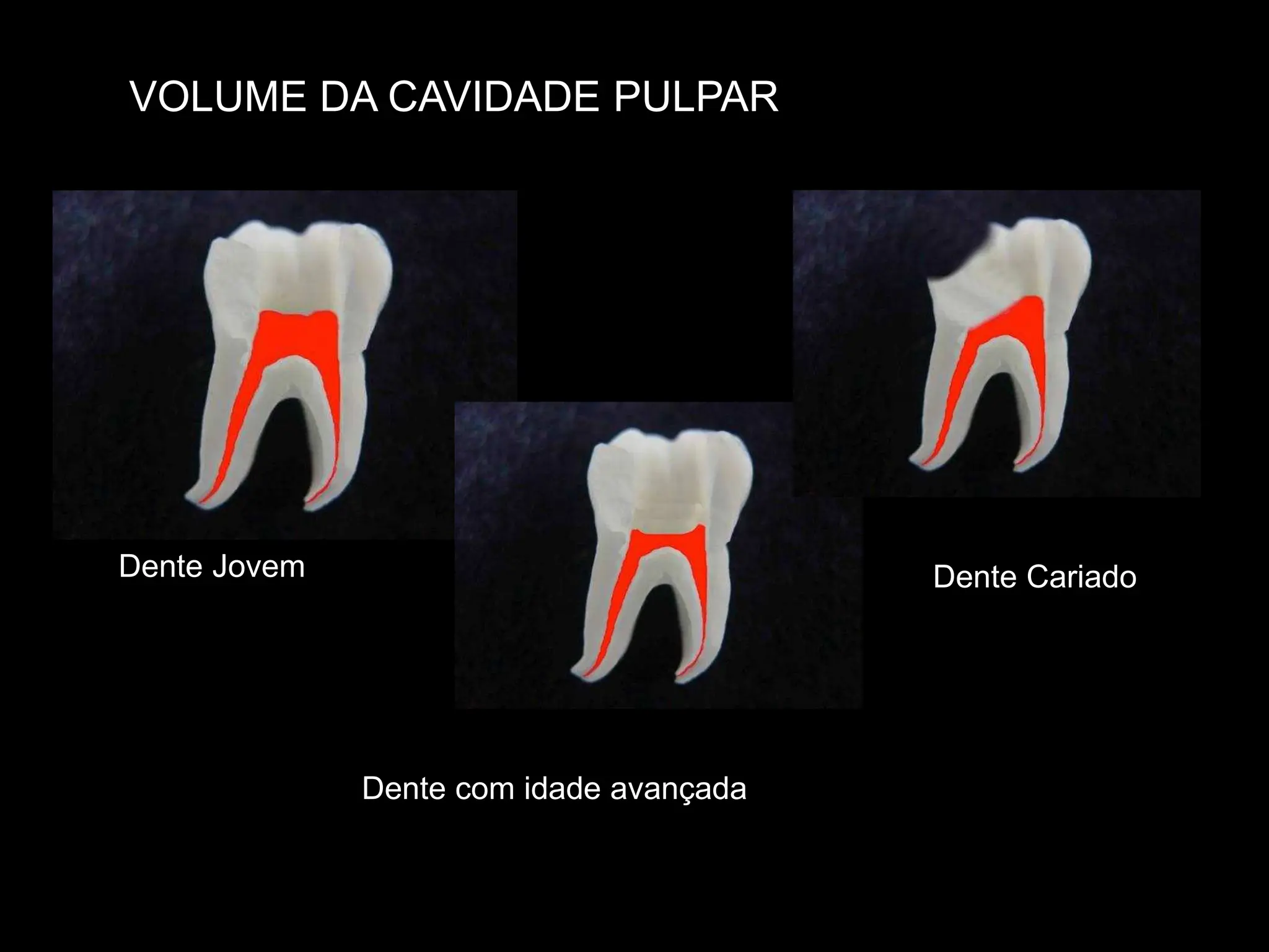 Topografia_e_anatomia_da_cavidade_pulpar.pdf
