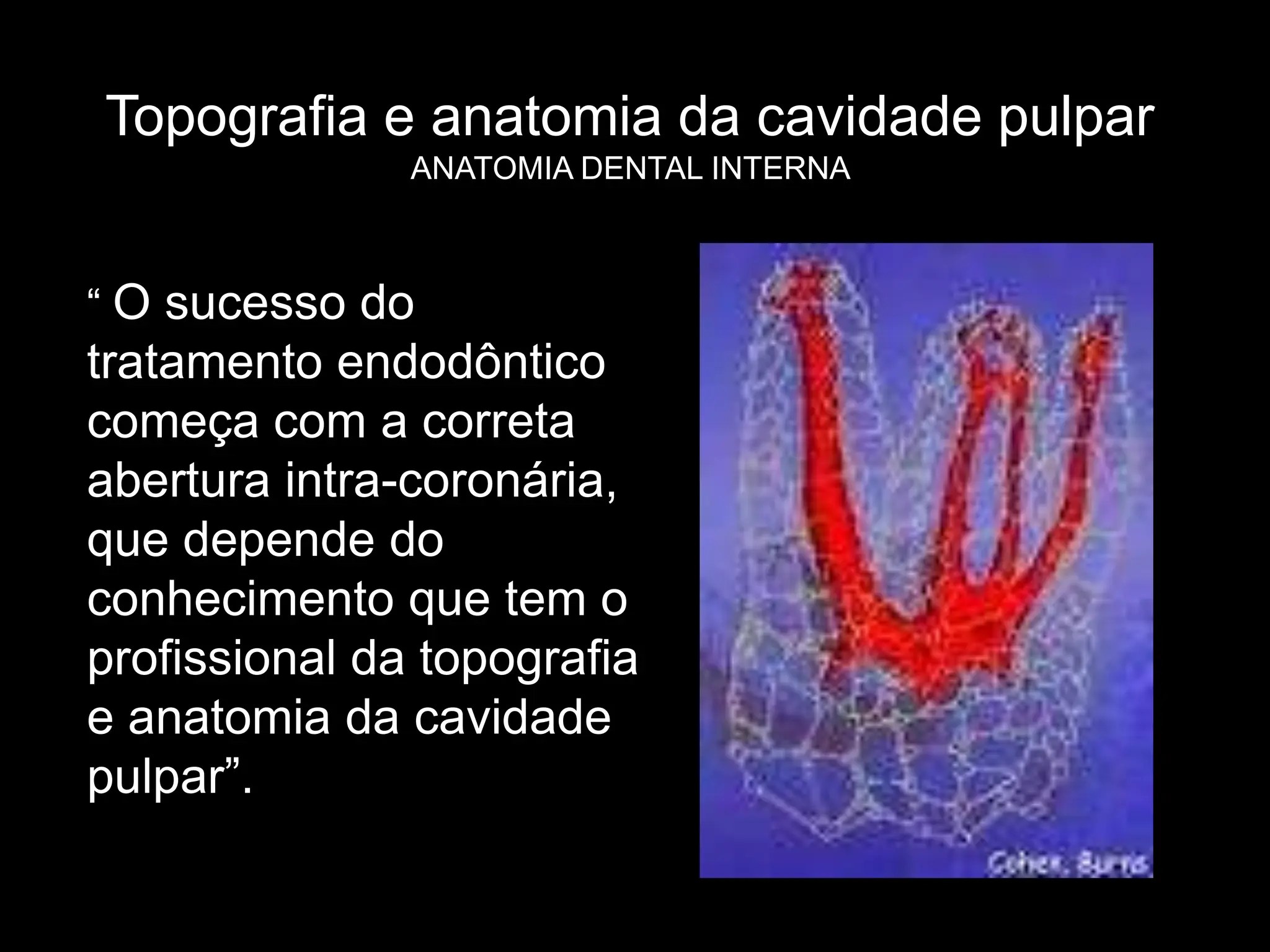Cavidade Pulpar