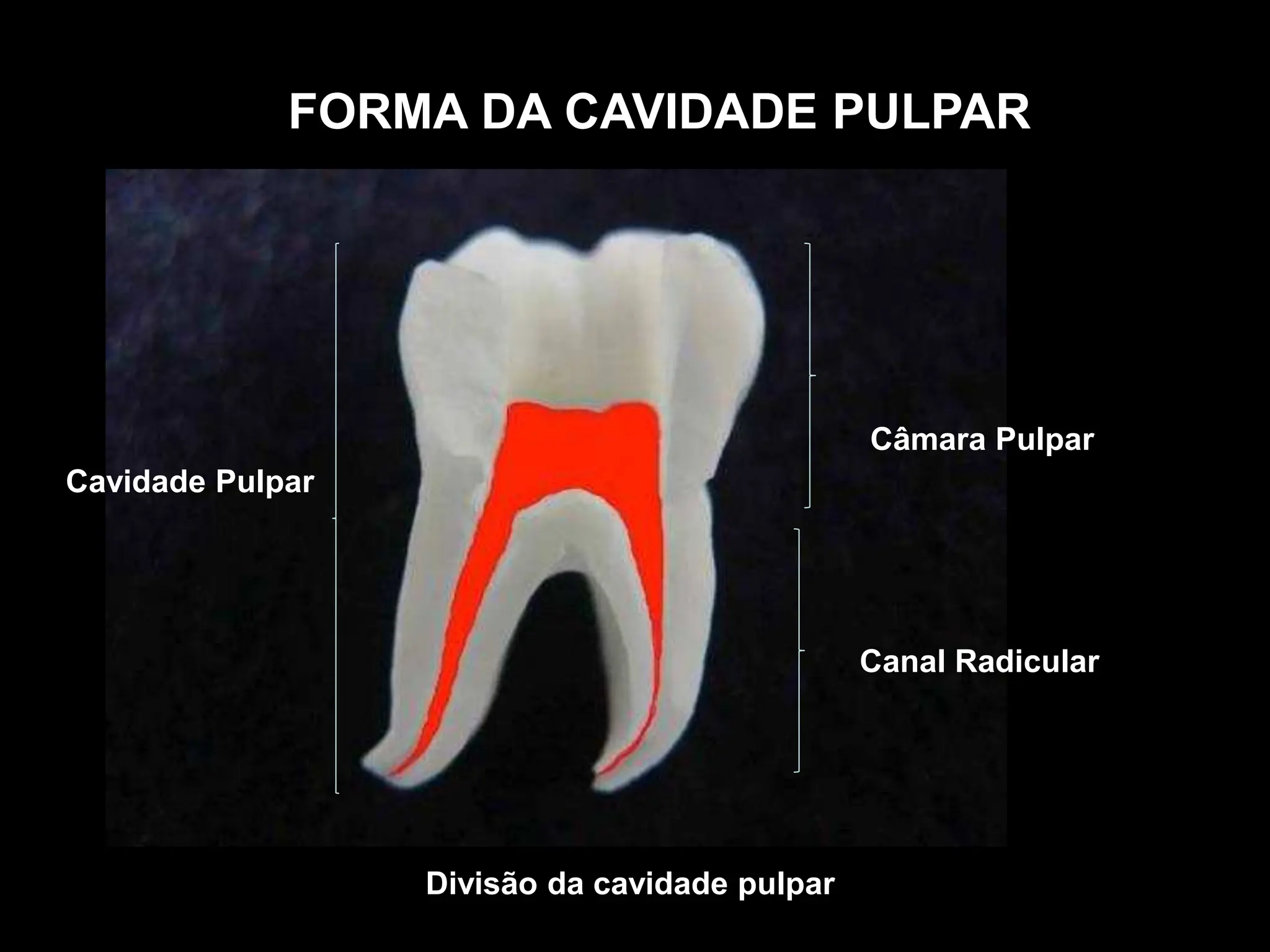 Topografia_e_anatomia_da_cavidade_pulpar.pdf