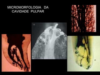 Topografia_e_anatomia_da_cavidade_pulpar.pdf
