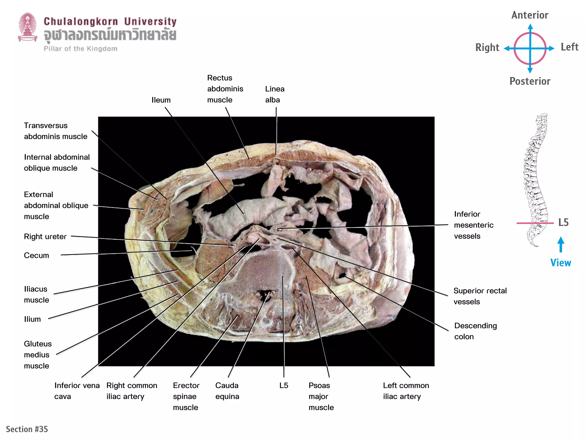 Topographic anatomy of abdomen | PDF