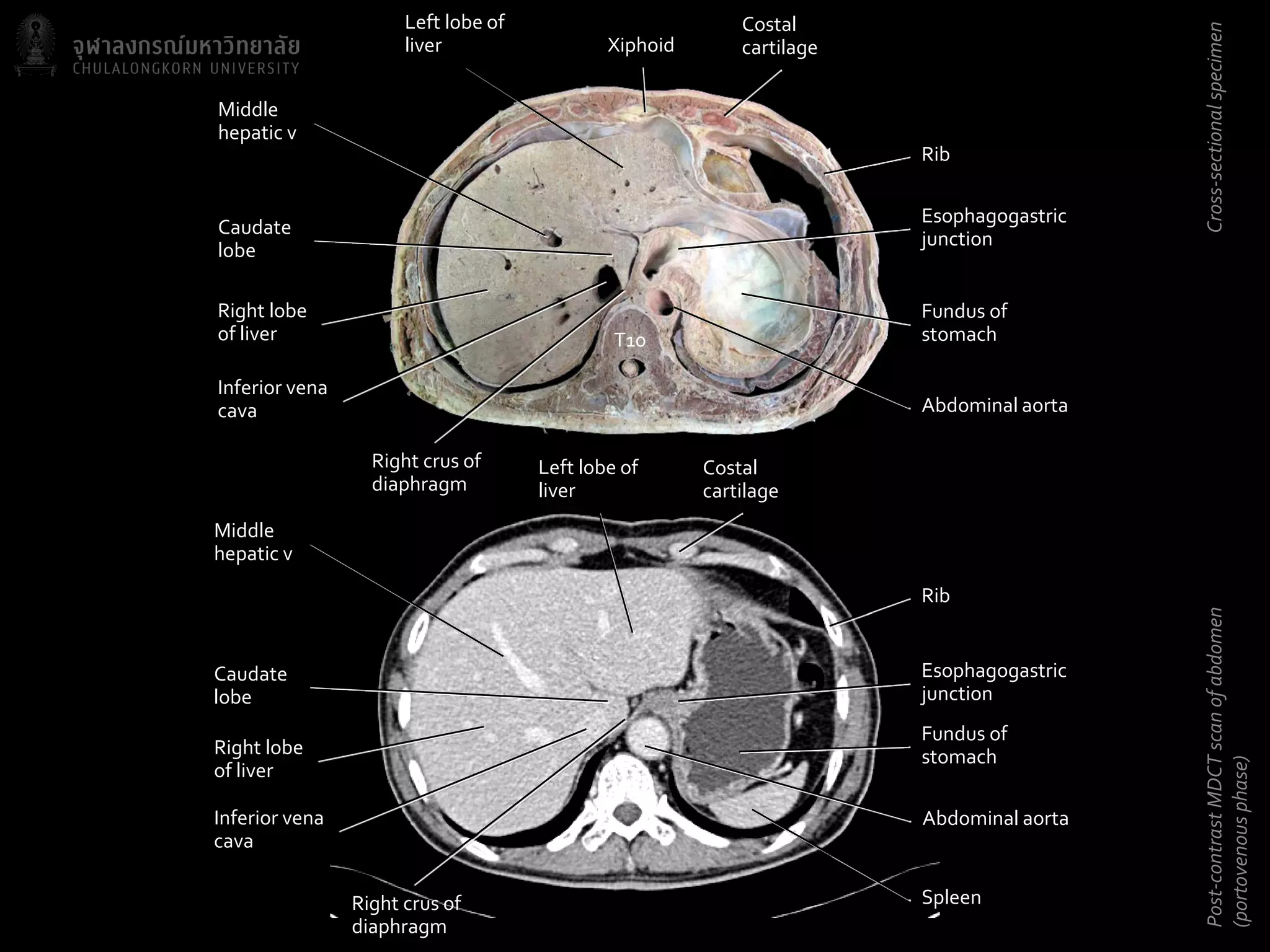 Topographic anatomy of abdomen | PDF