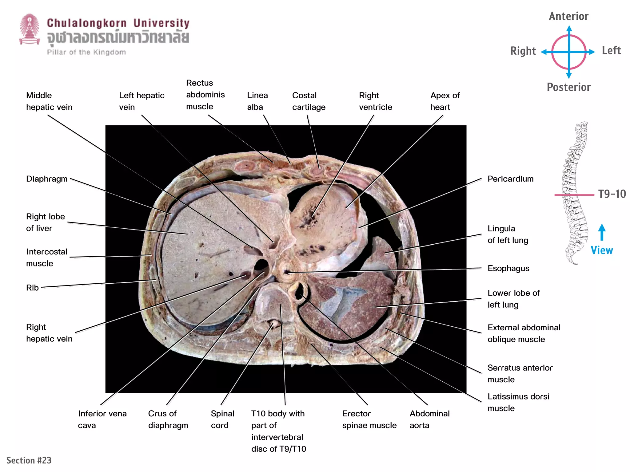 Topographic anatomy of abdomen | PDF