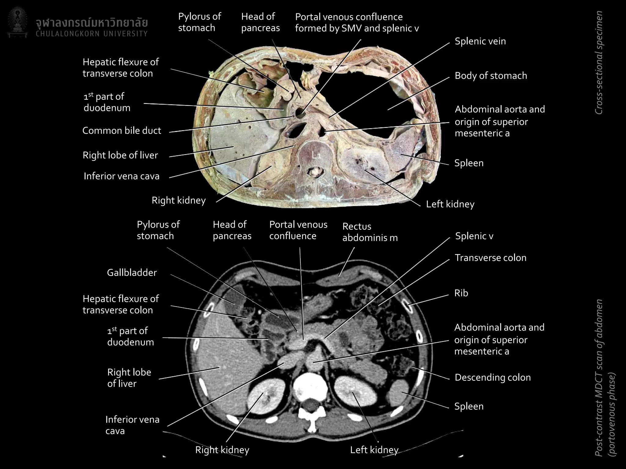 Topographic anatomy of abdomen | PDF