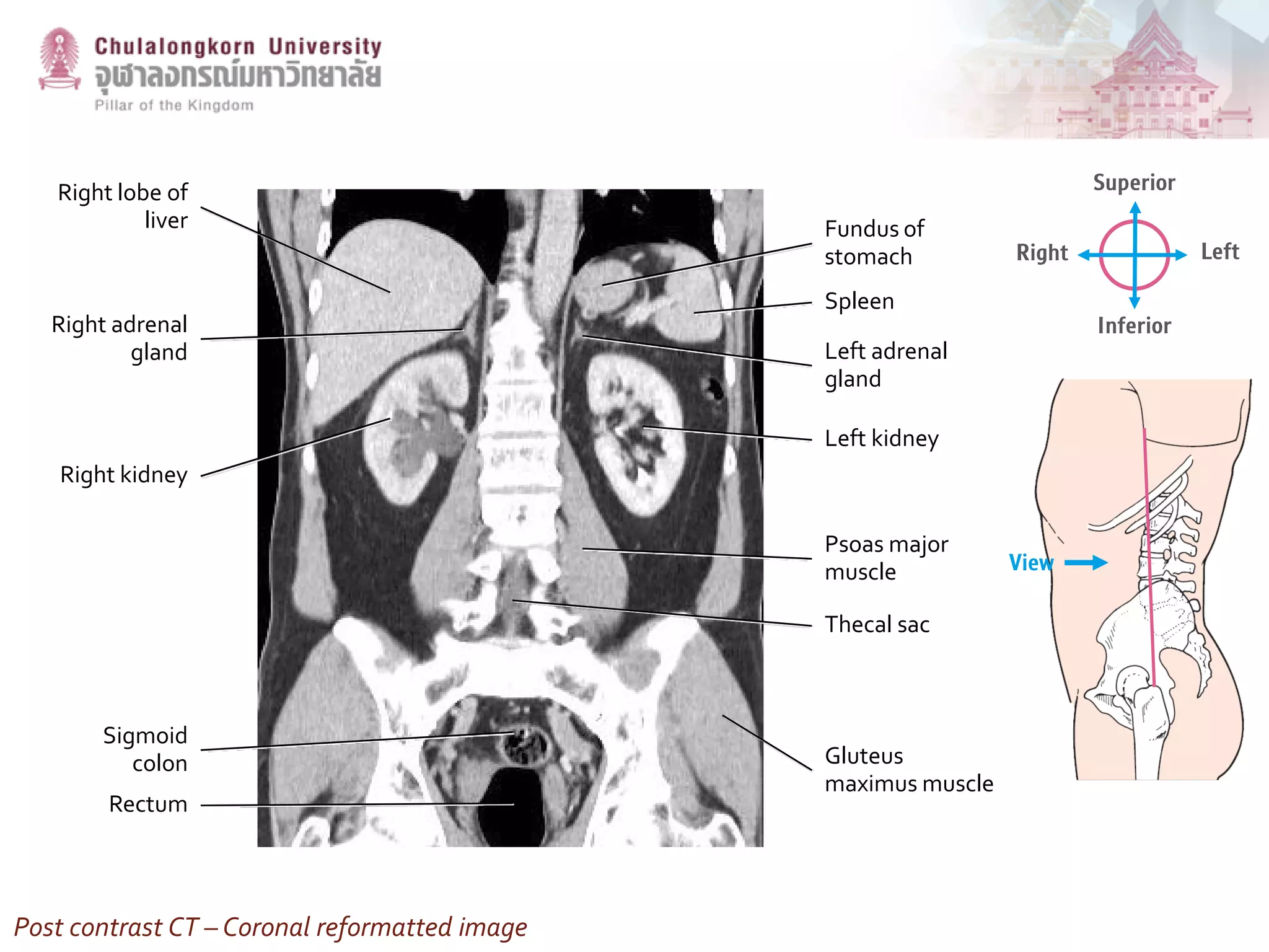 Topographic anatomy of abdomen | PDF