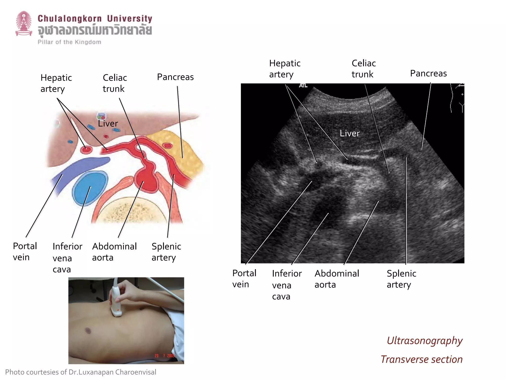 Topographic anatomy of abdomen | PDF