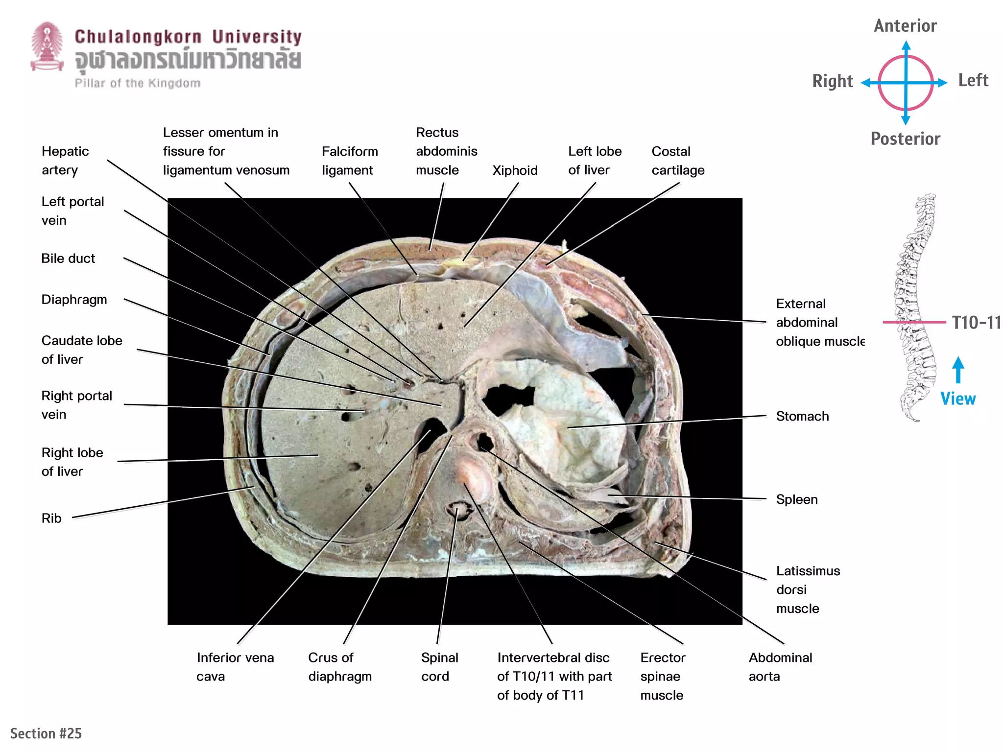 Topographic anatomy of abdomen | PDF