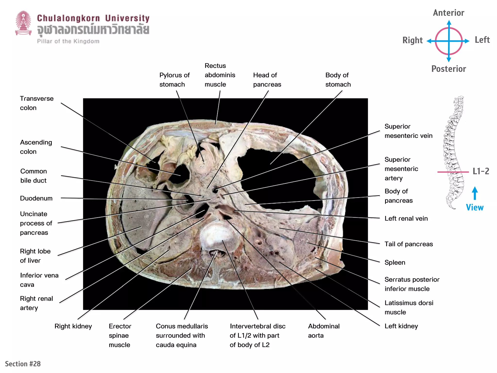 Topographic anatomy of abdomen | PDF
