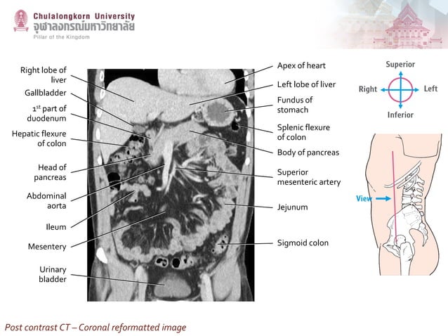Topographic anatomy of abdomen | PDF