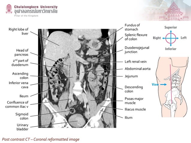 Topographic anatomy of abdomen | PDF