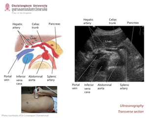 Topographic anatomy of abdomen | PDF