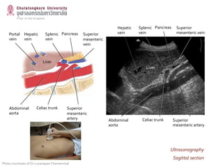Topographic anatomy of abdomen | PDF