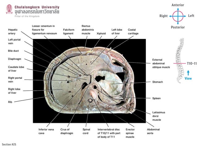 Topographic anatomy of abdomen | PDF