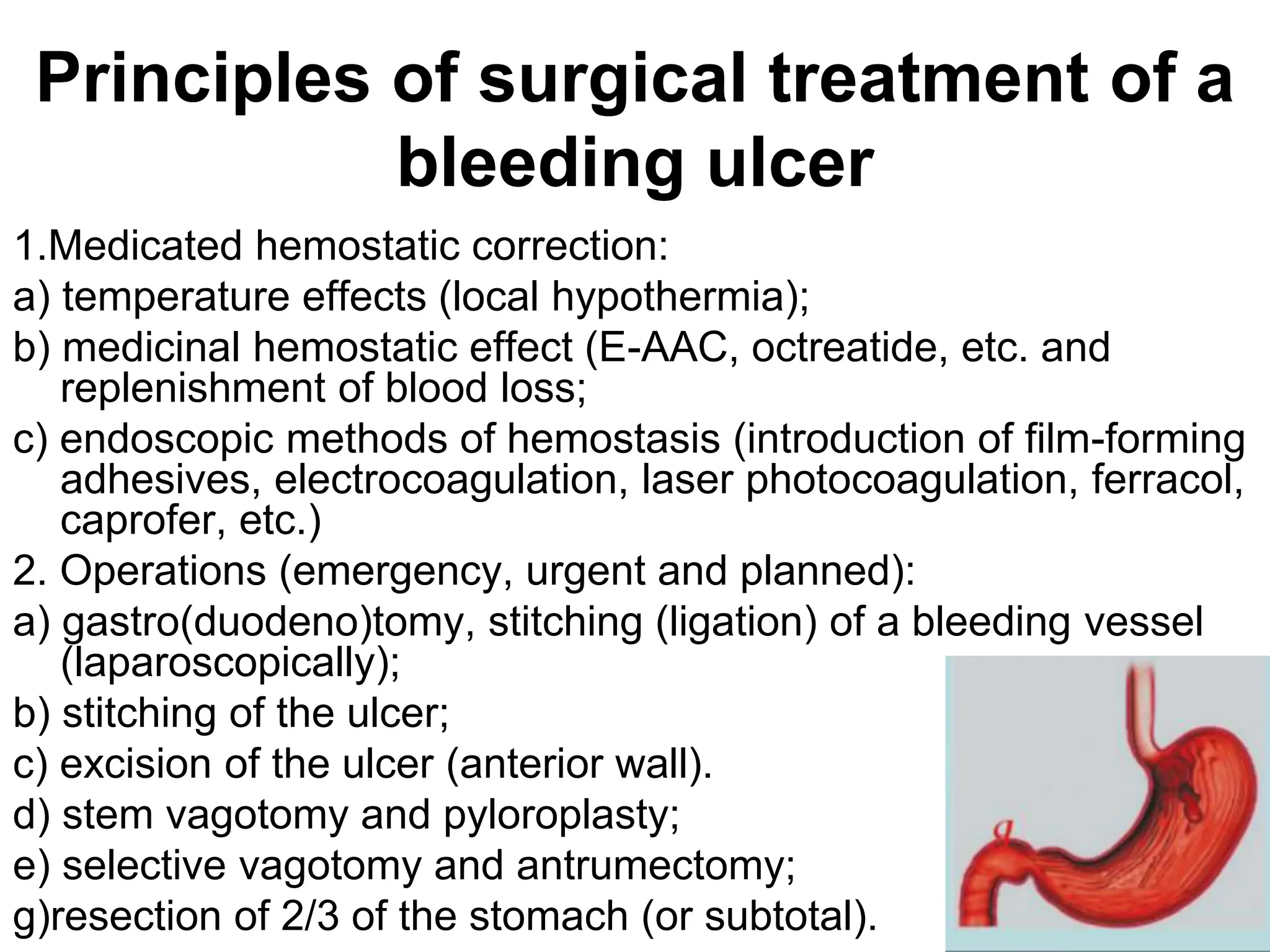 Topographic anatomy and operative surgery of the stomach.pdf