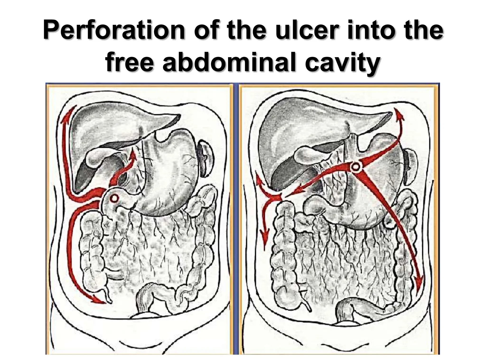 Topographic anatomy and operative surgery of the stomach.pdf