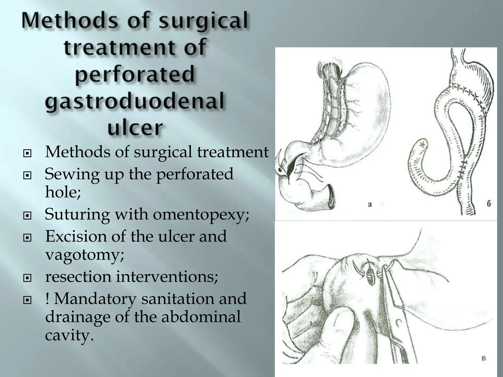 Topographic anatomy and operative surgery of the stomach.pdf