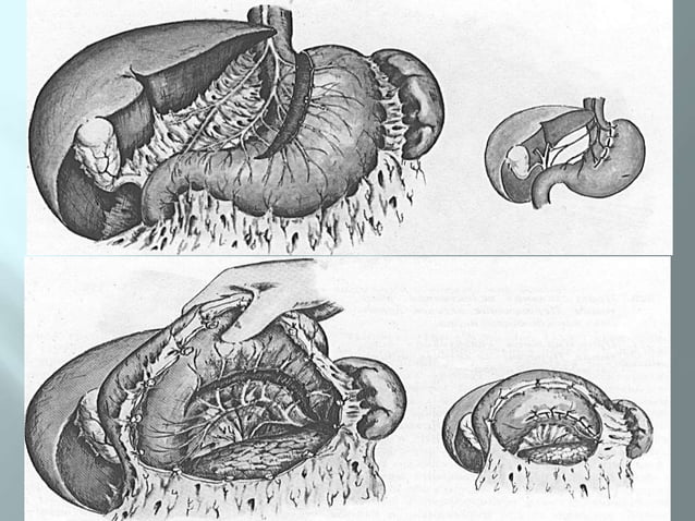 Topographic anatomy and operative surgery of the stomach.pdf