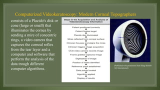 TOPOGRAPHY of cornea (corneal imaging).pptx
