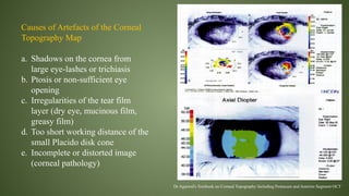 TOPOGRAPHY of cornea (corneal imaging).pptx