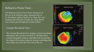 TOPOGRAPHY of cornea (corneal imaging).pptx