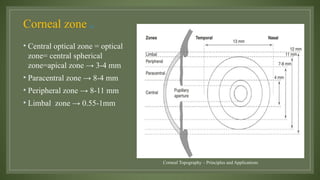TOPOGRAPHY of cornea (corneal imaging).pptx