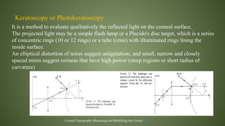 TOPOGRAPHY of cornea (corneal imaging).pptx