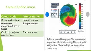 TOPOGRAPHY .pdf | Eye and Vision Conditions | Diseases and Conditions