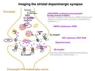 Topography and functional significance of the dopaminesgic dysfunction ...