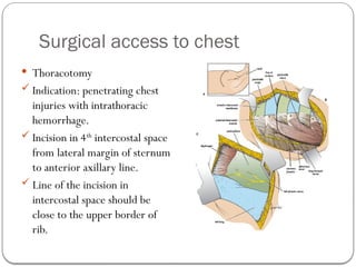 topography of the chest - грудная клетка 2 варниант.pptx
