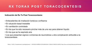 TORACOCENTESIS S E P A R EFUSION PLEURAL | PPTX