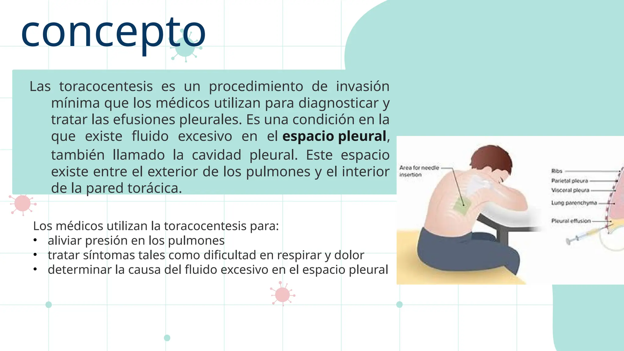 TORACOCENTESIS procedimiento para derrame pleural.pptx
