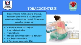 Toracocentesis (1) | PPT