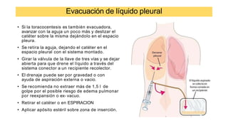 TORACOCENTESIS DERRAME PLEURAL EXPO PARA ENTENDER EL PROCEDIMIENTO | PPTX