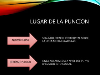 Toracocentesis e insercion de sonda pleural | PPTX