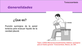 Toracocentesis, toracostomia y trampa de agua.pdf