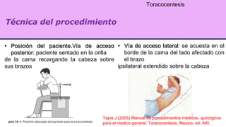 Toracocentesis, toracostomia y trampa de agua.pdf