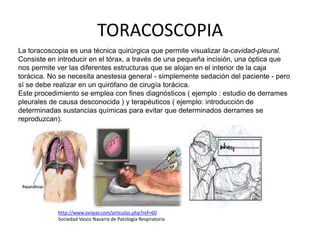 Toracoscopia Gloria Quintero | PPT