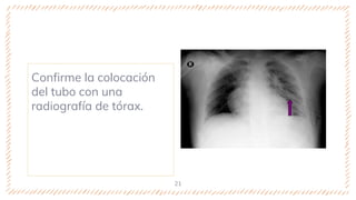 Toracostomia cerrada y toracocentesis | PPTX