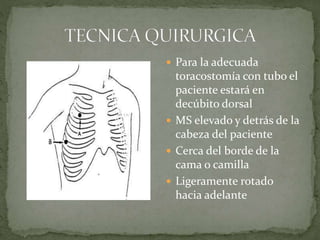 Toracostomia con tubo | PPTX