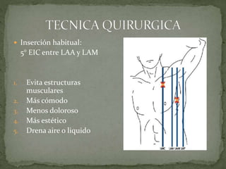 Toracostomia con tubo | PPTX