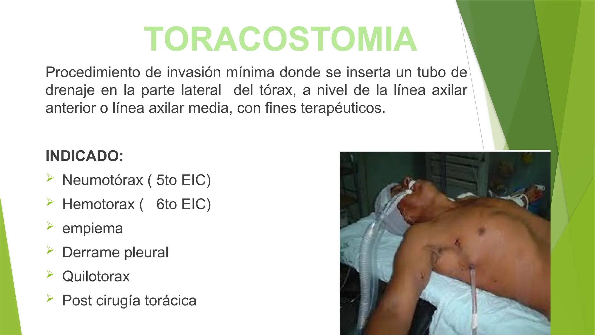 toracostomia y toracotomia en unidad de cuidados intensivos.pptx