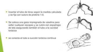 toracostomia y toracotomia en unidad de cuidados intensivos.pptx