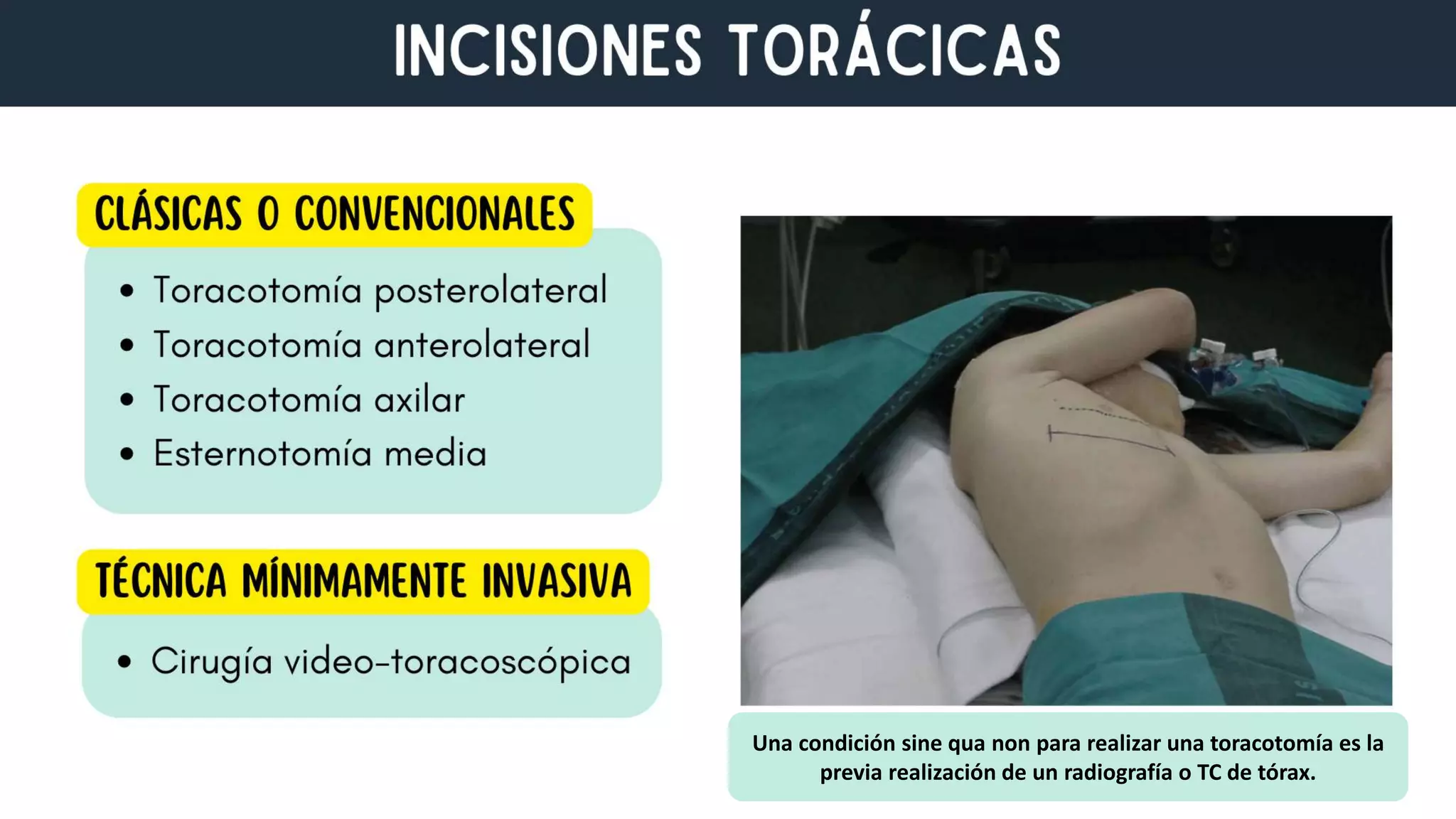 TORACOTOMÍA EXPLORATORIA-CLASE III.pptx