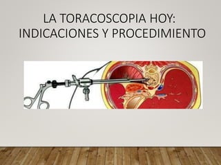 TORACOTOMIAS.pptx