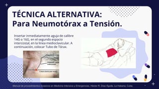 TORACOTOMIA, TORACOCENTESIS Y DRENAJE-1.pptx