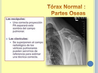 Torax | PPTX